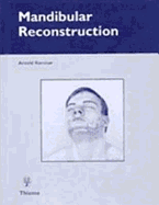 Mandibular Reconstruction by Arnold Komisar - Alibris